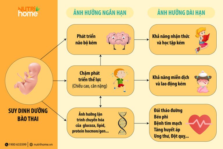 Trẻ suy dinh dưỡng: nguyên nhân, dấu hiệu và cách phòng ngừa