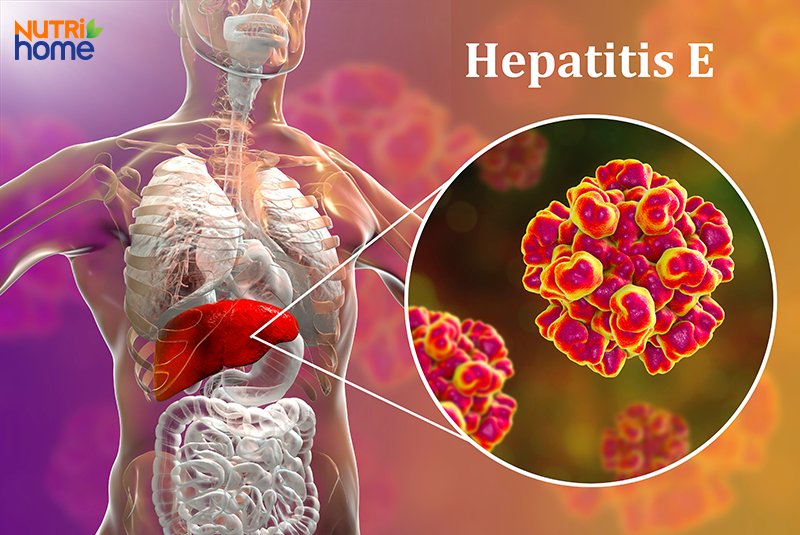 Viêm gan virus: Triệu chứng, đường lây nhiễm và phòng ngừa